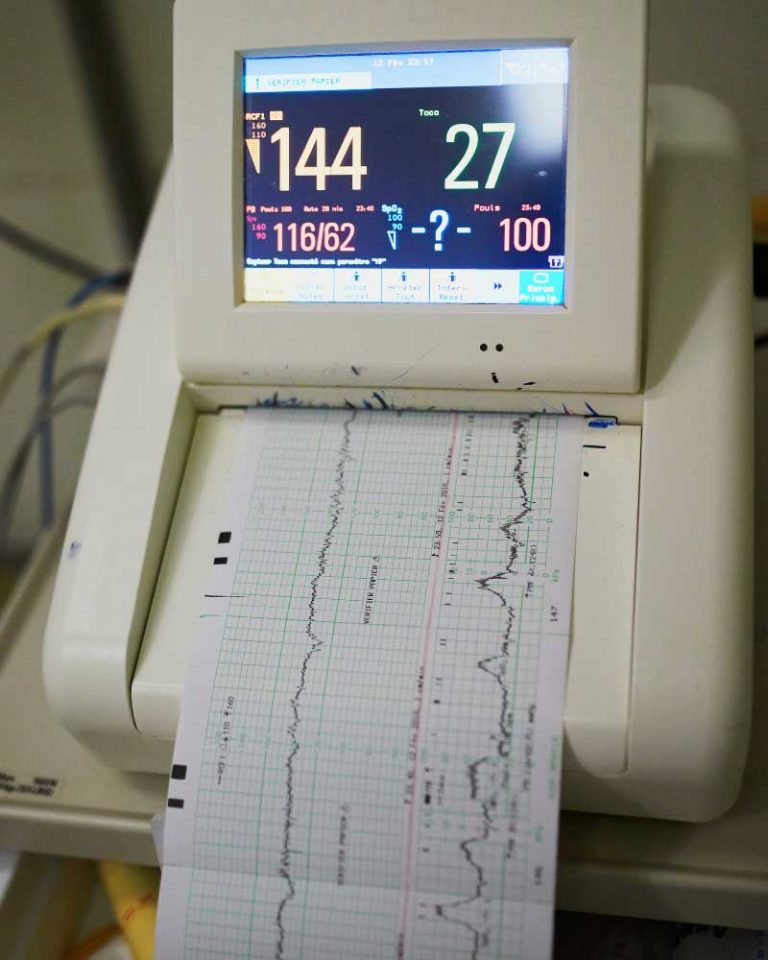 Kada CTG pregled nagoveštava dolazak bebe? - Rastimo zdravo