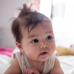 Crveni obrazi kod beba: uzroci i lečenje - Rastimo zdravo